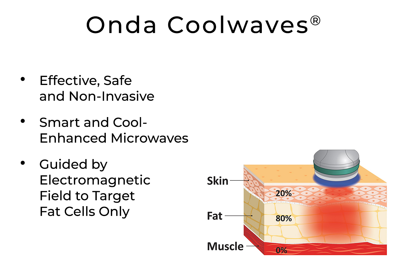 Onda - EPION Aesthetics